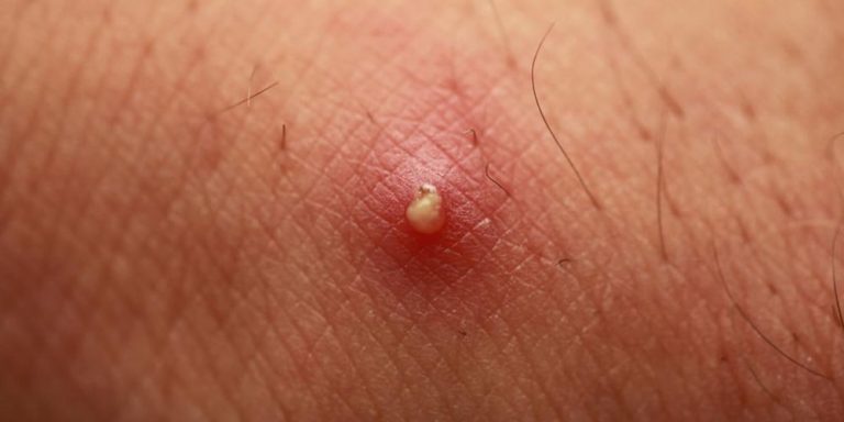DERMATOLOGY SERVICES | Cibolo Creek Dermatology Group